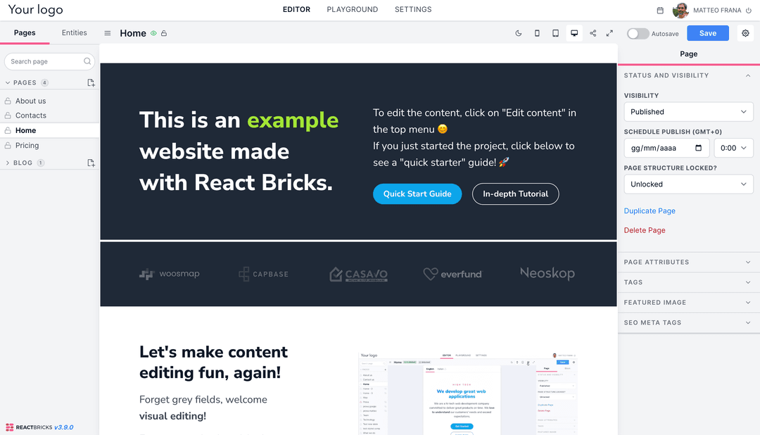 Admin Interface And Visual Editor React Bricks Tutorial